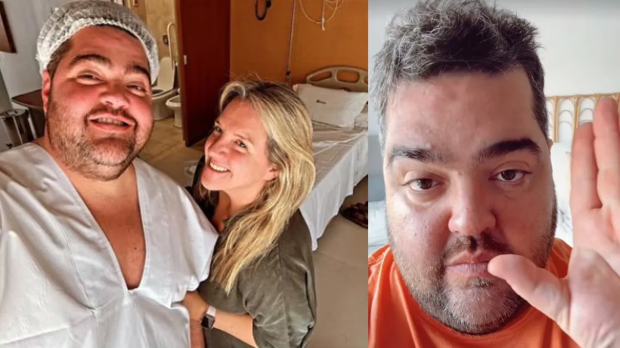 Darío Barassi recibió el alta médica tras someterse a una cirugía ...